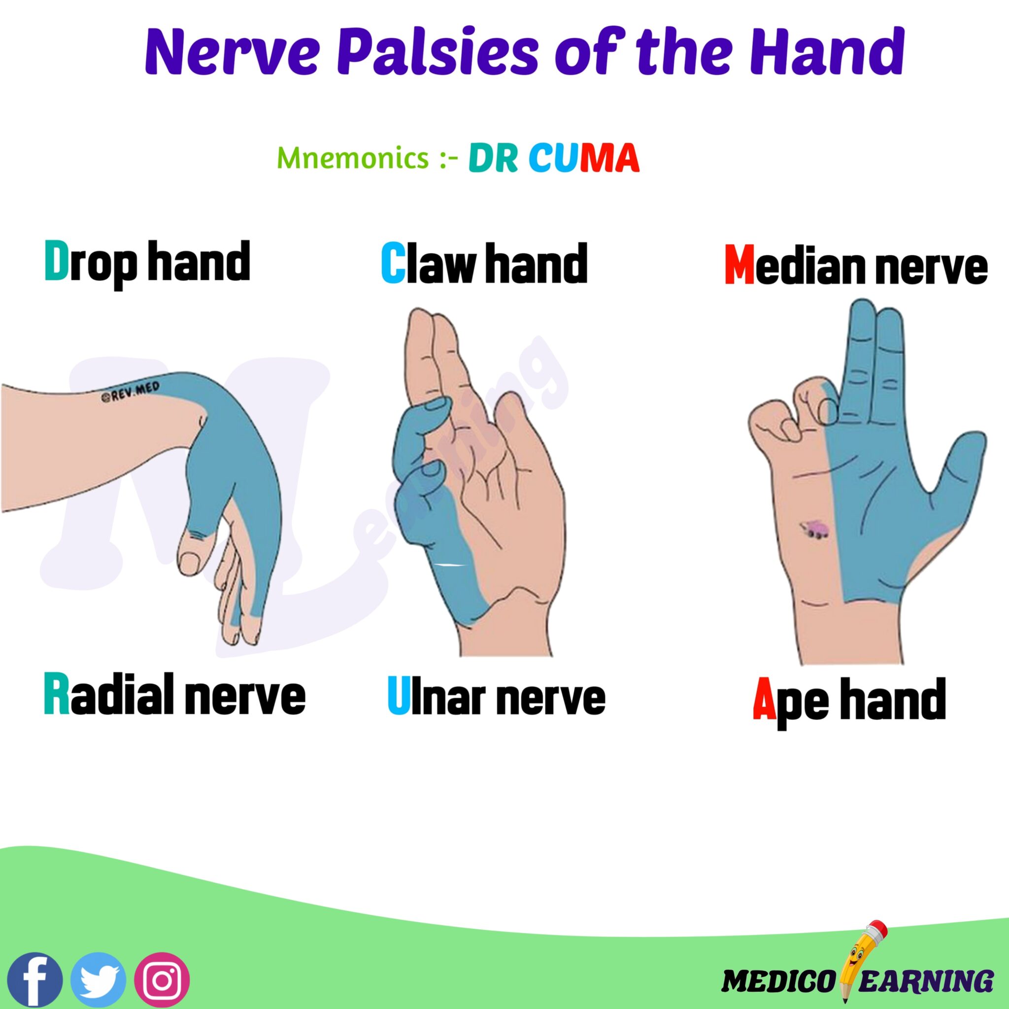 Calot’s triangle boundaries Mnemonic – MedicoLearning