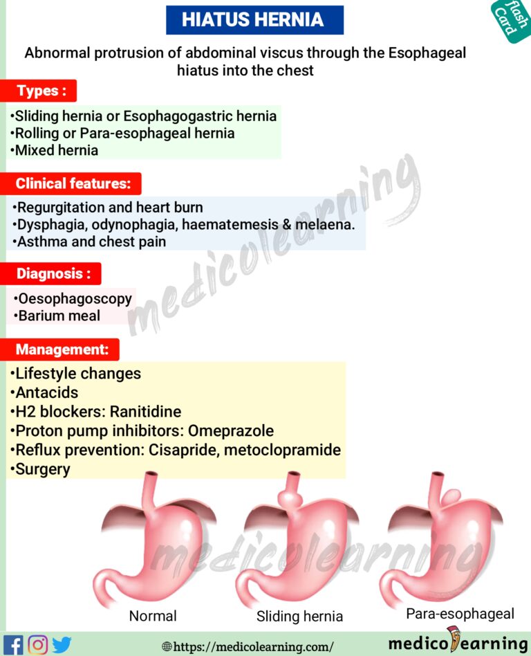 HIATUS Hernia – MedicoLearning