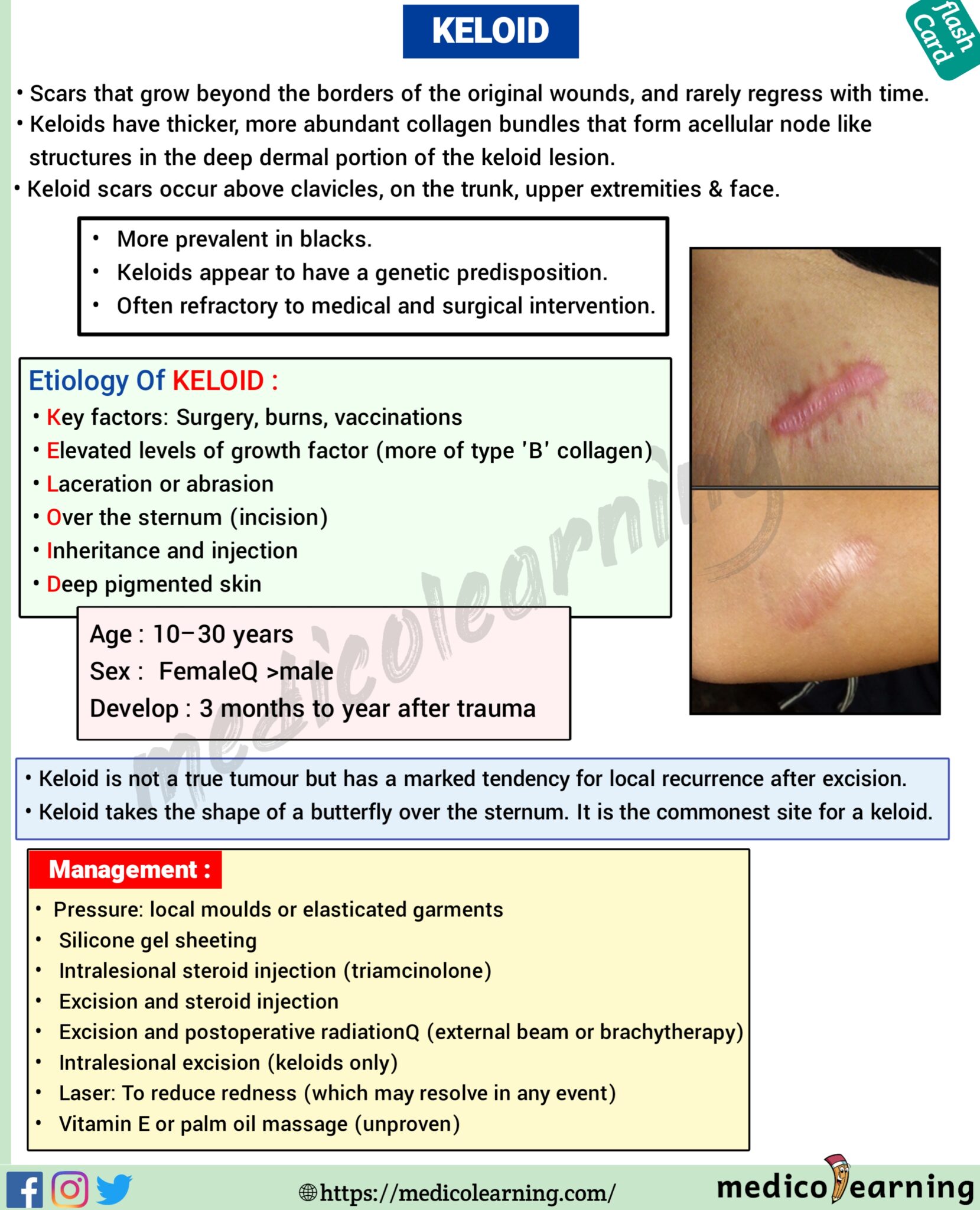 Difference between Hypertrophic Scar and Keloid – MedicoLearning