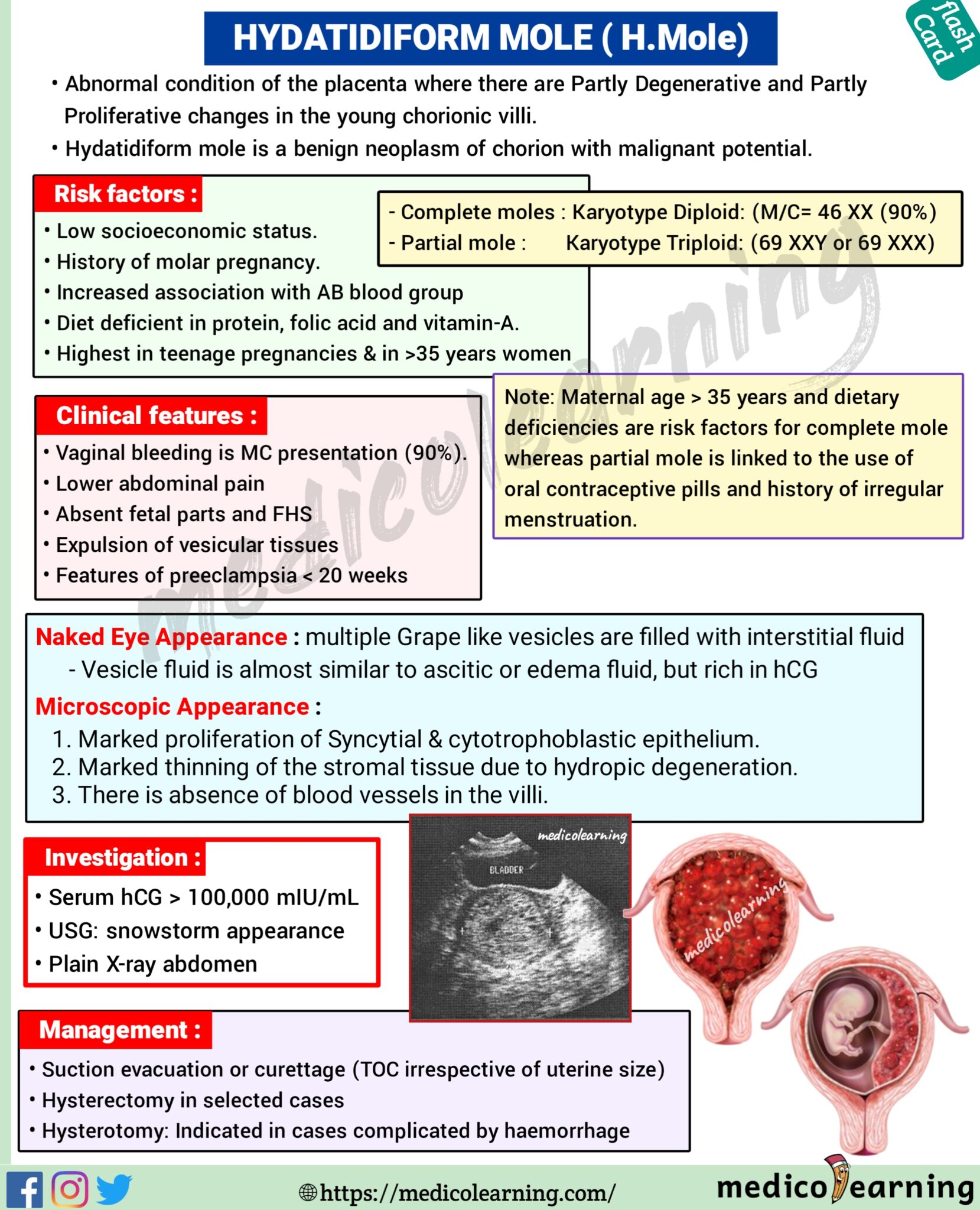 Hydatidiform Mole – MedicoLearning
