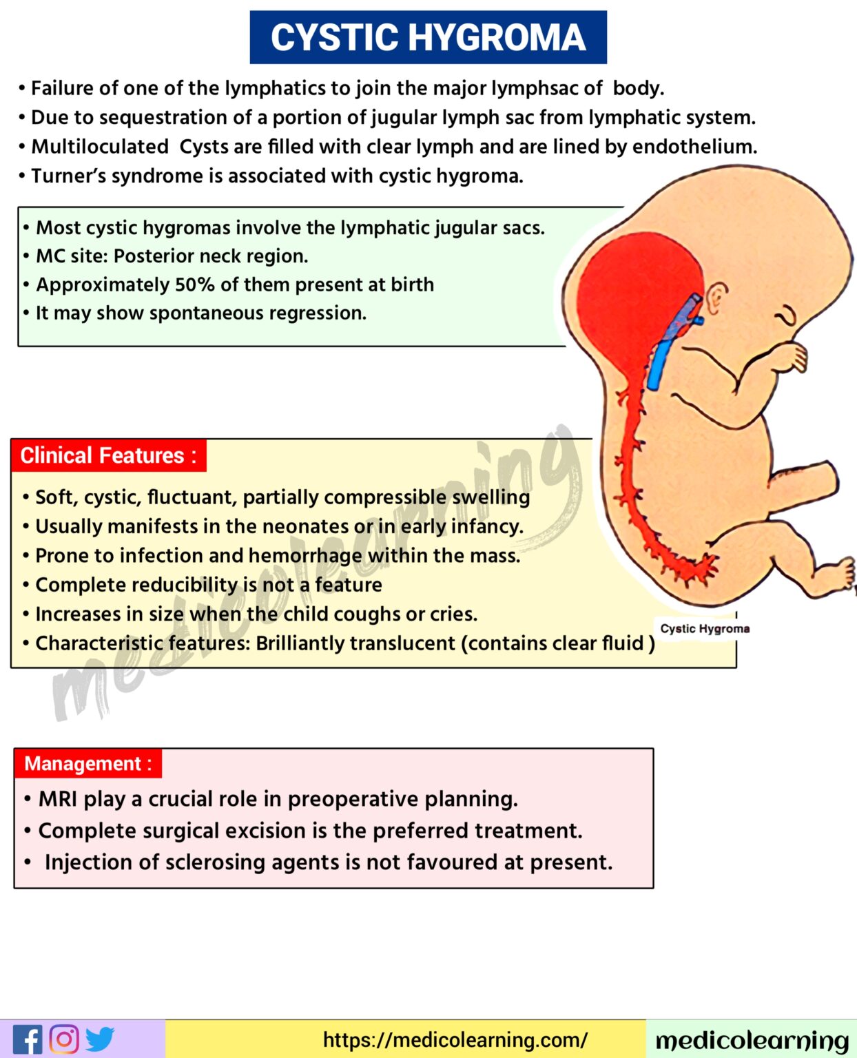Cystic Hygroma – MedicoLearning