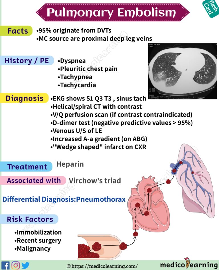 Pulmonary embolism – MedicoLearning