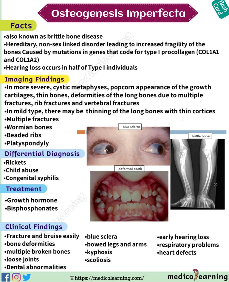 Osteogenesis imperfecta – MedicoLearning