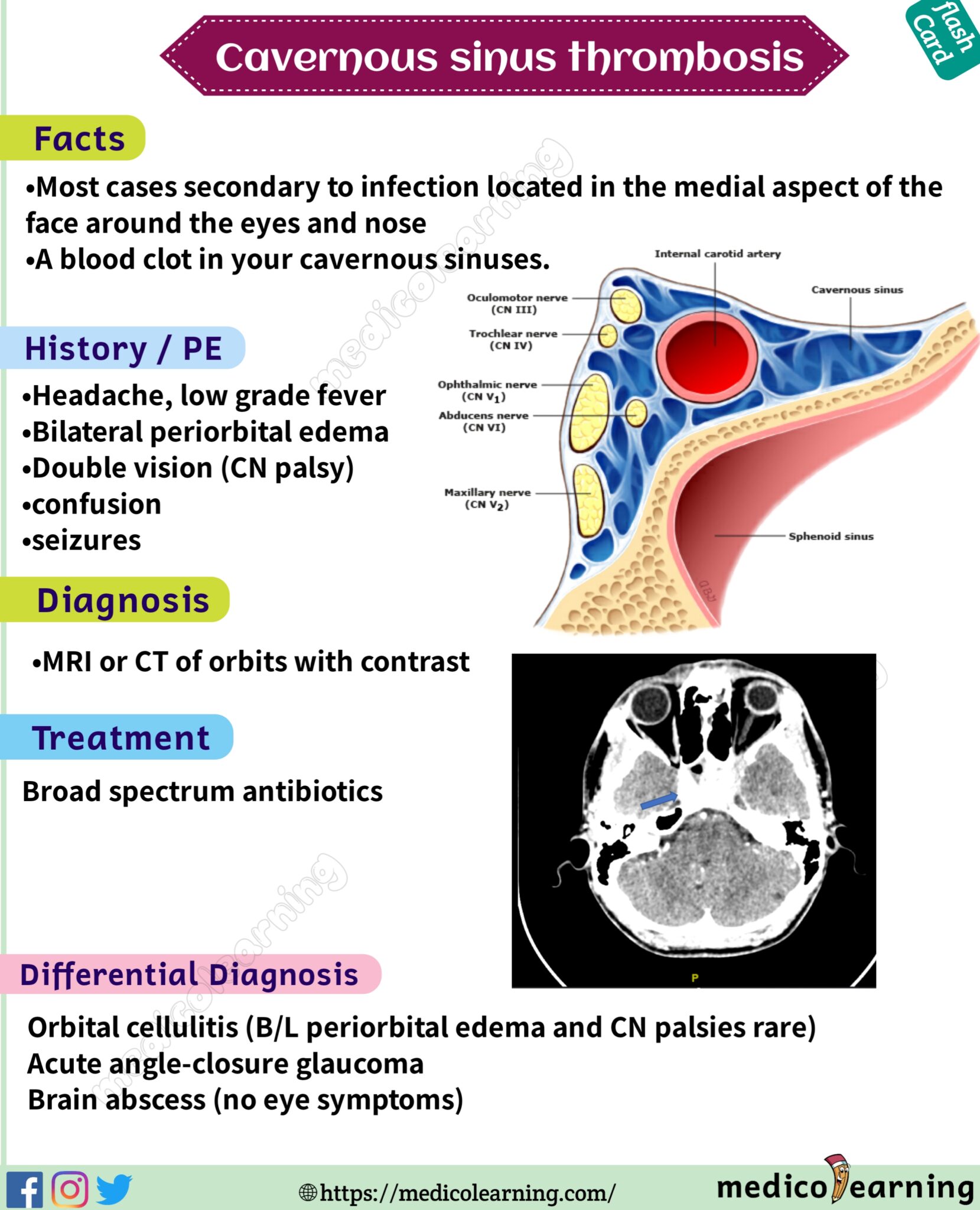 cavernous sinus thrombosis – MedicoLearning