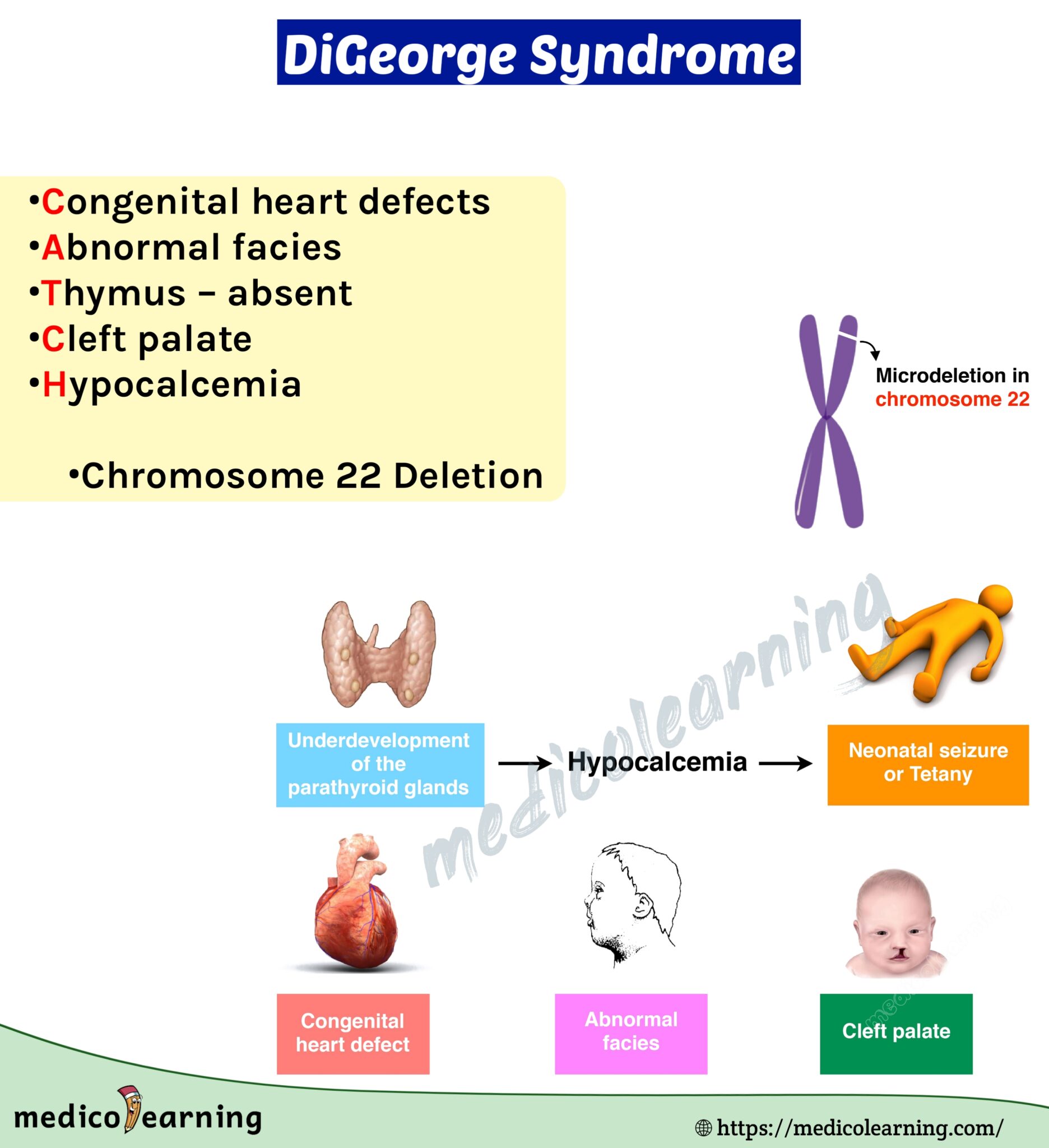 DiGeorge syndrome – MedicoLearning