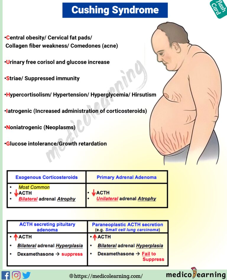 Cushing’s syndrome (hypercortisolism) – MedicoLearning