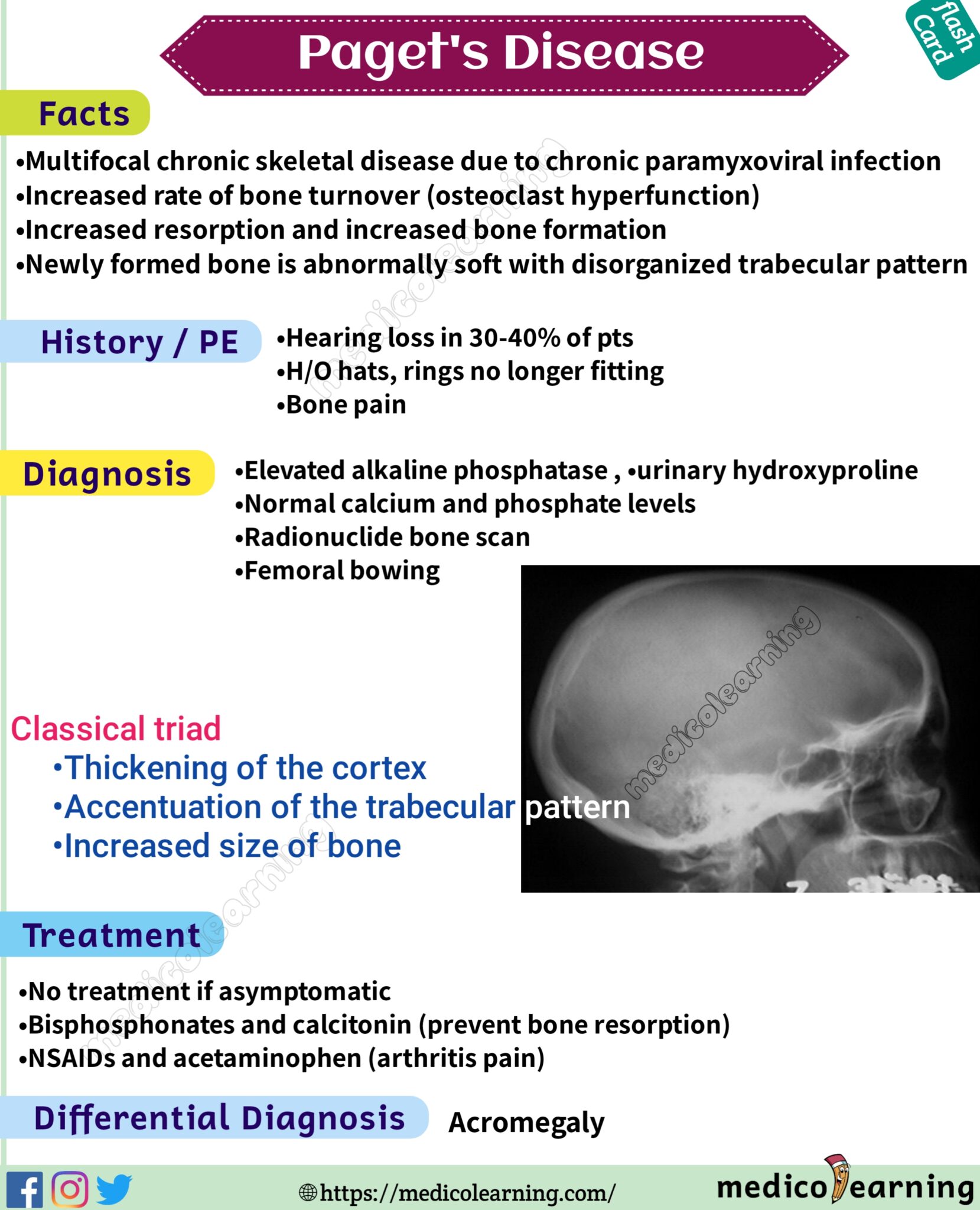 Paget’s disease – MedicoLearning