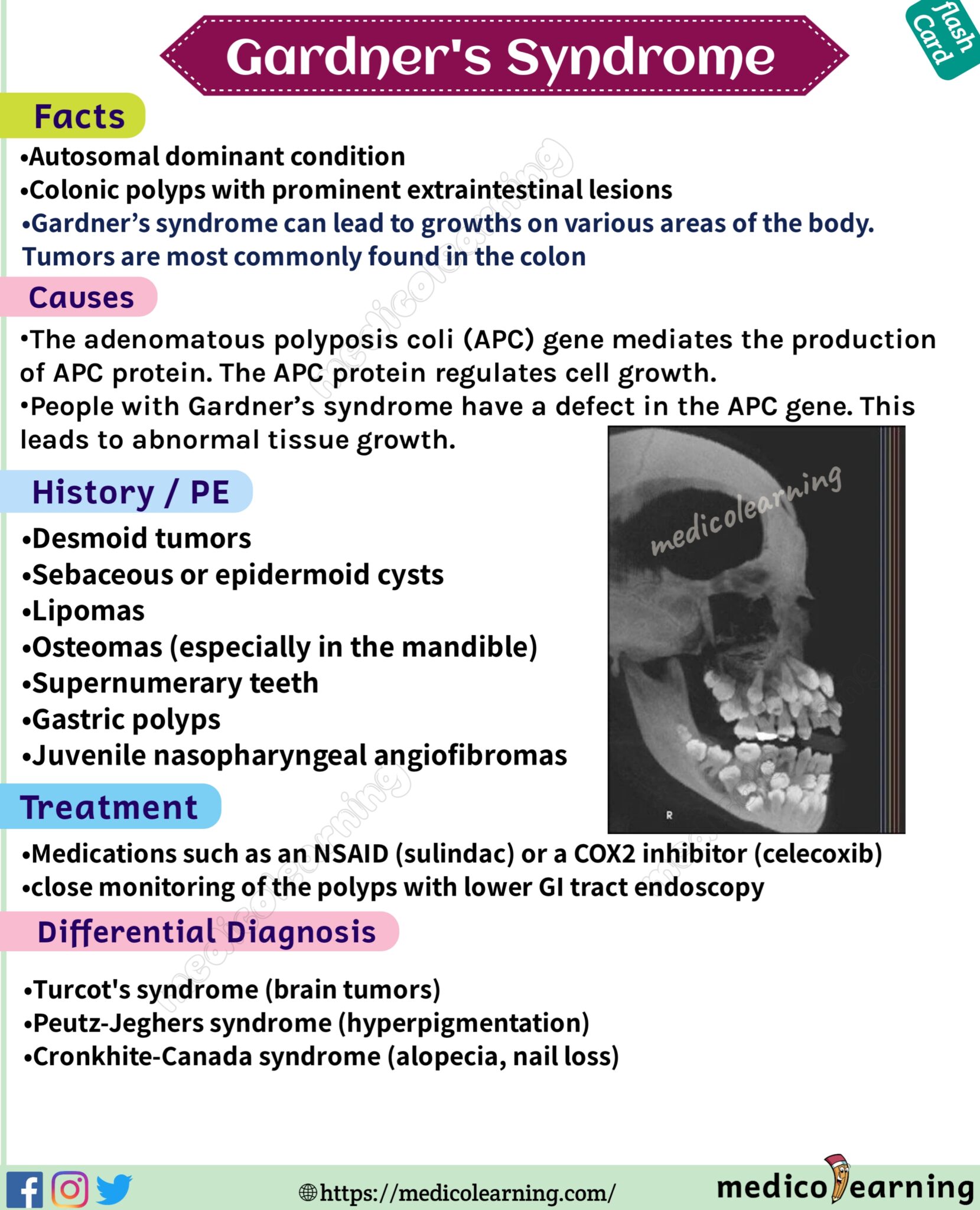 Gardner syndrome – MedicoLearning