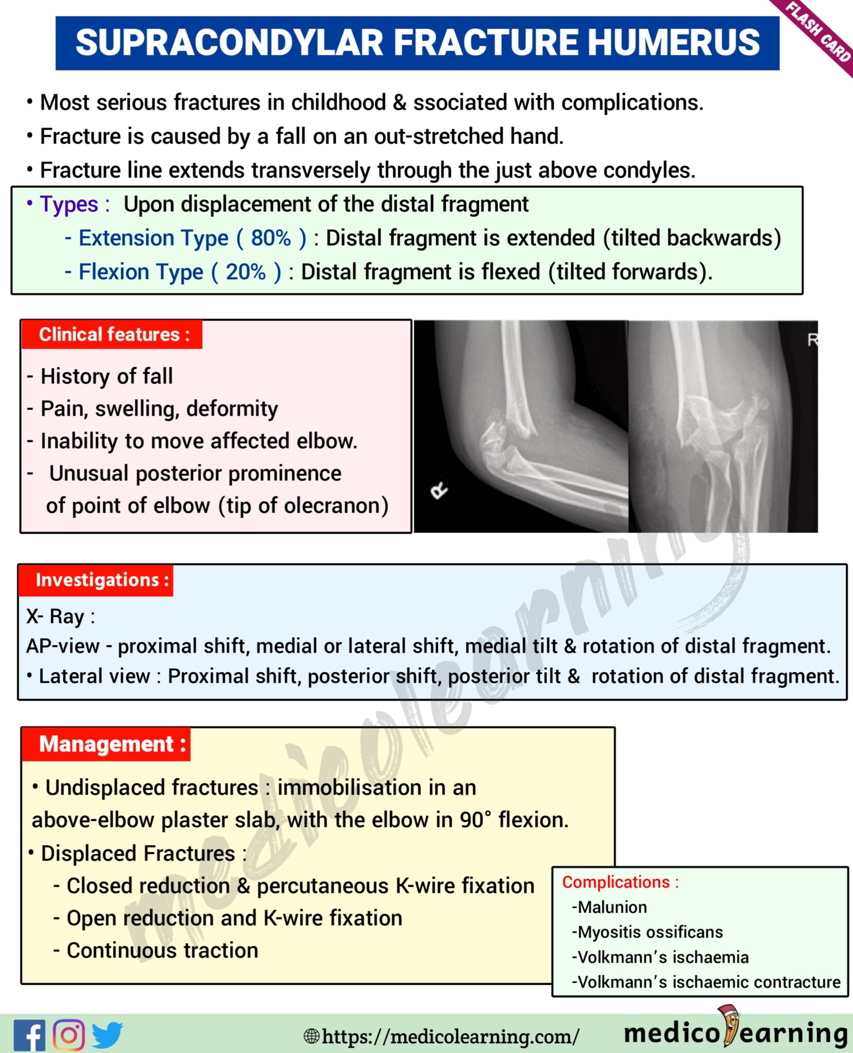 Supracondylar Fracture Of Humerus – MedicoLearning