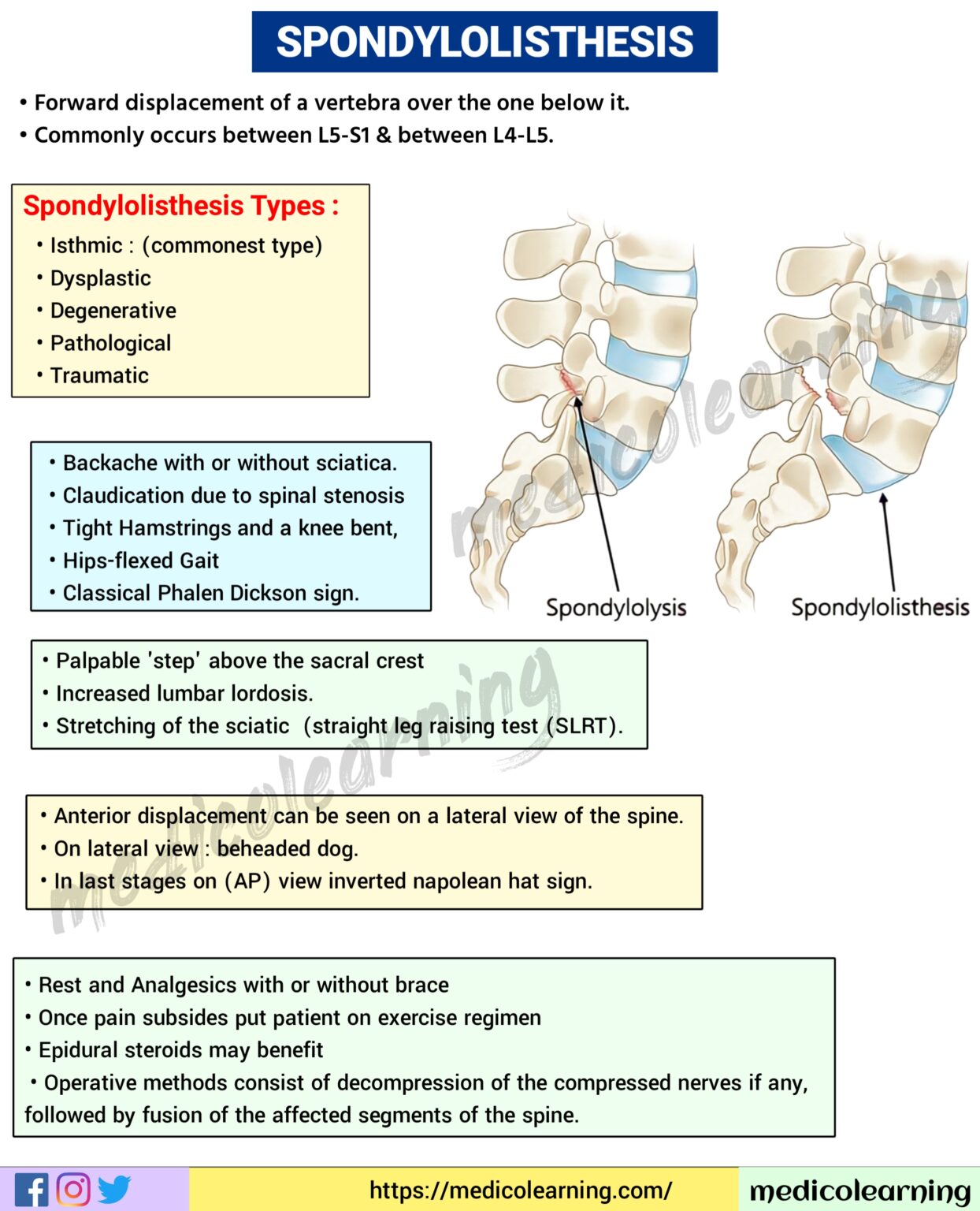 Spondylolisthesis – MedicoLearning