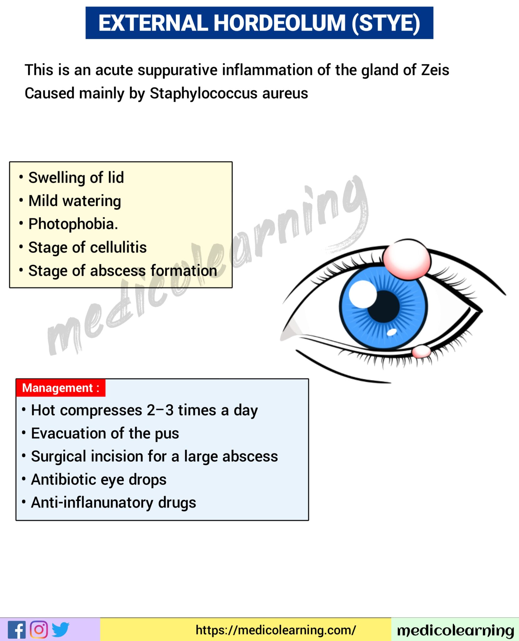 tram track Appearance – MedicoLearning