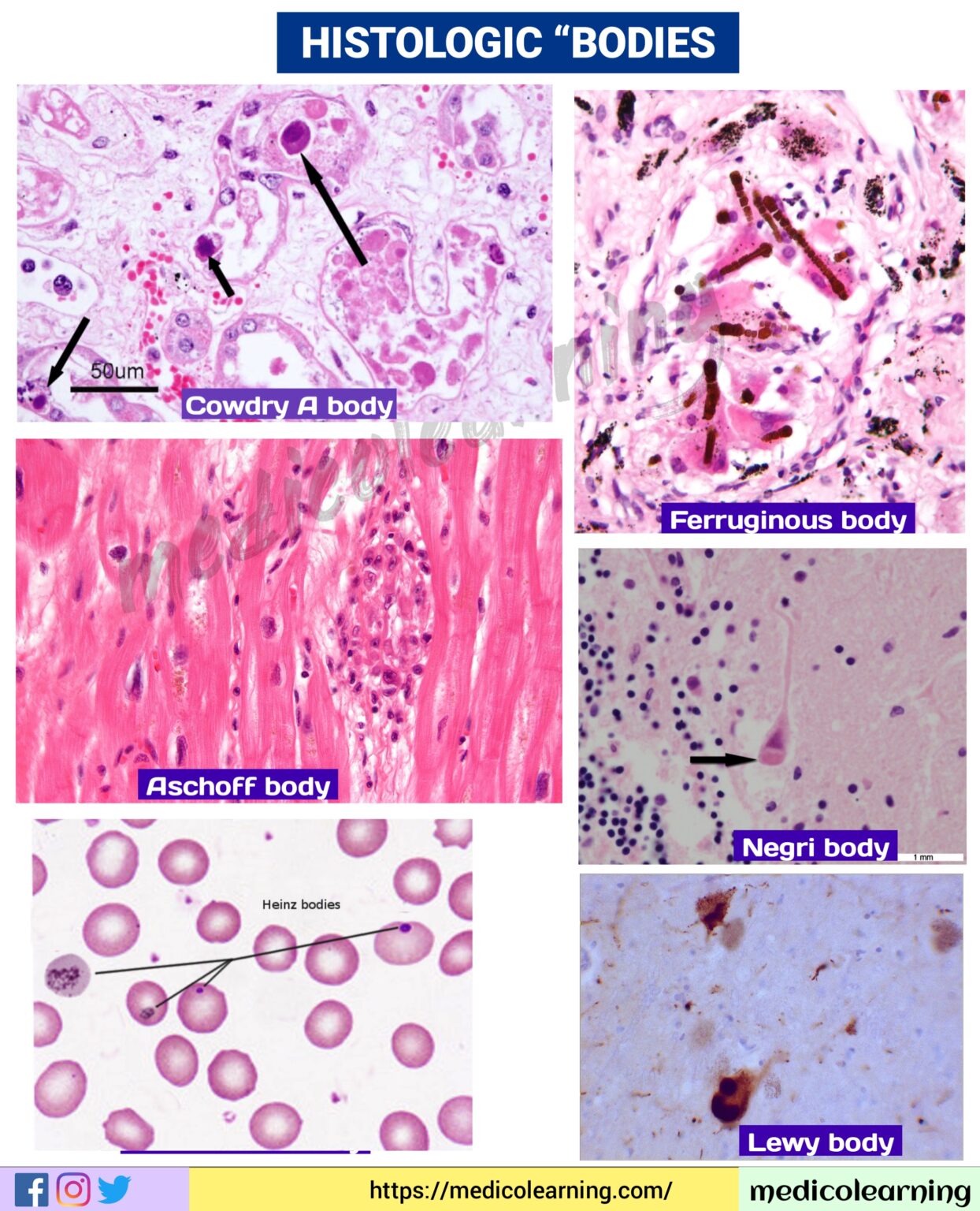 Histologic Bodies – MedicoLearning