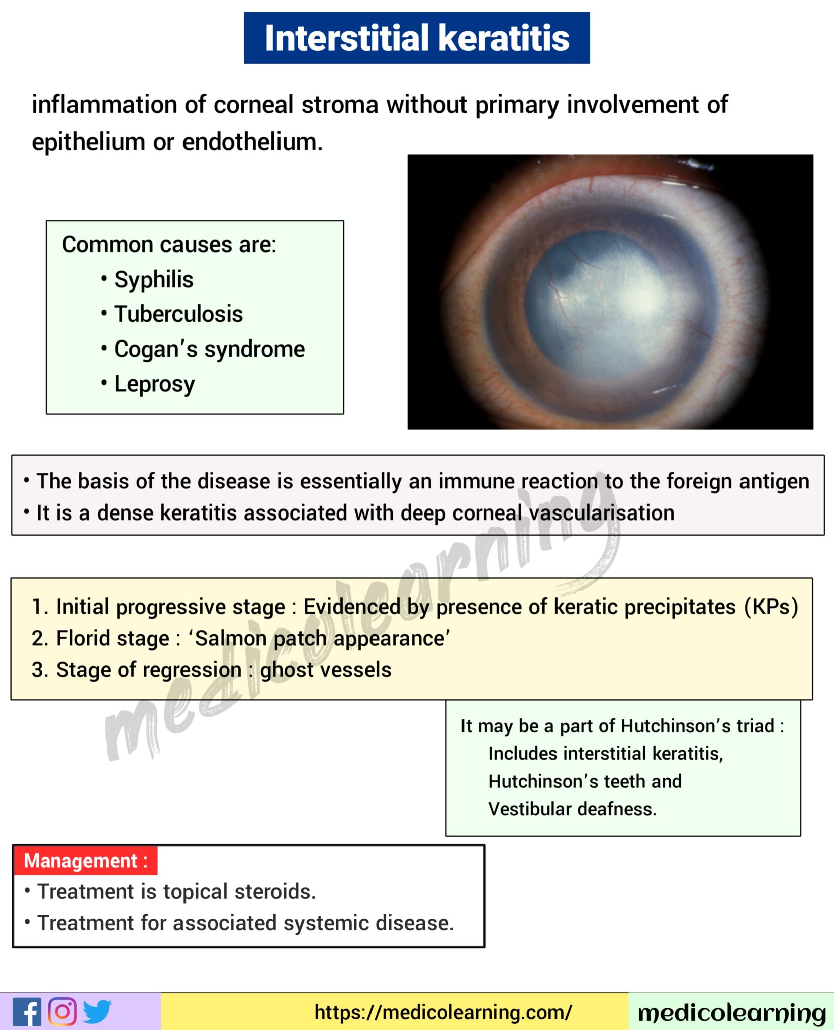 Interstitial Keratitis – MedicoLearning